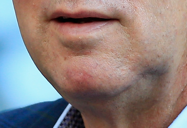 Whose Disgusting Owner Chin Is This? | Defector