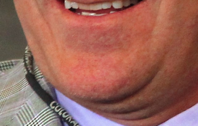 Whose Disgusting Owner Chin Is This? | Defector